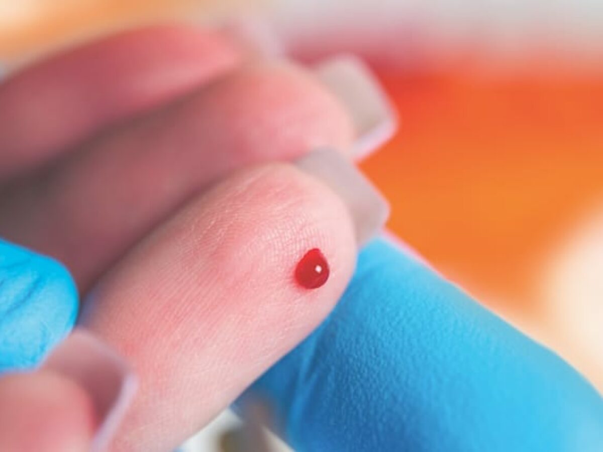 Capillary and Venous Blood Sampling Devices Market to Gain Value of US ...