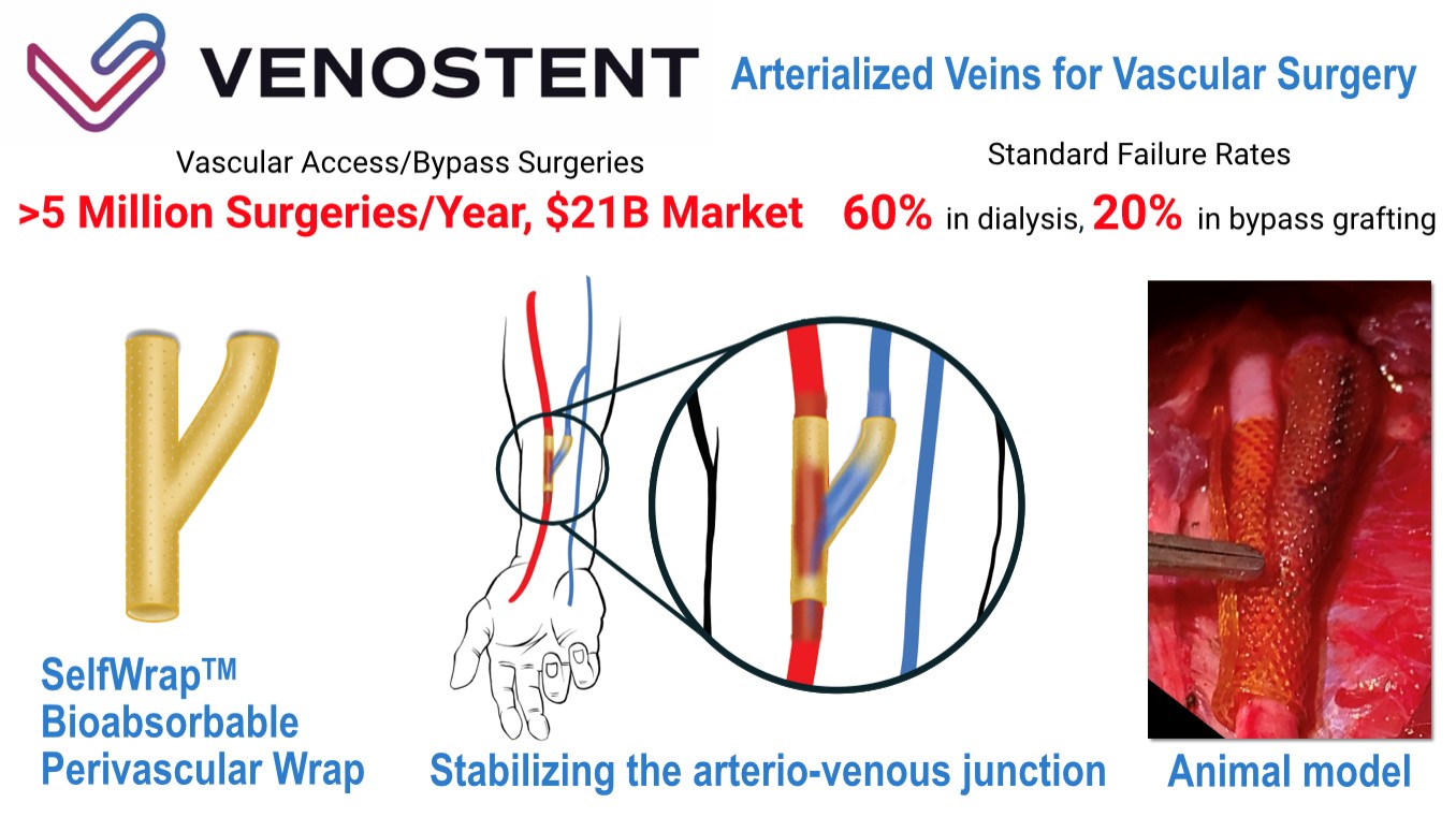 VenoStent Completes $16M Series A Financing, Receives IDE Approval from ...