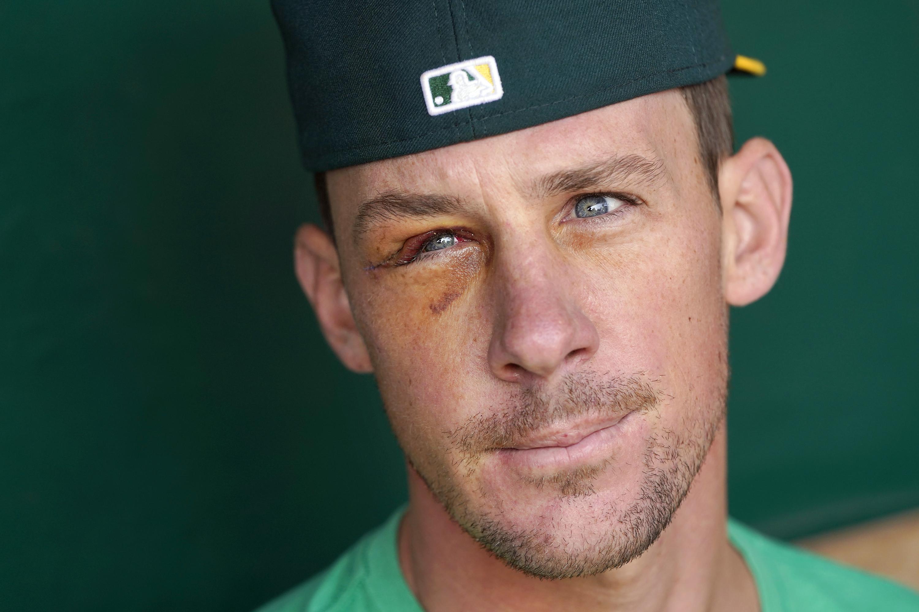 Bassitt to start for A's, 5 weeks after being hit in head | AP News