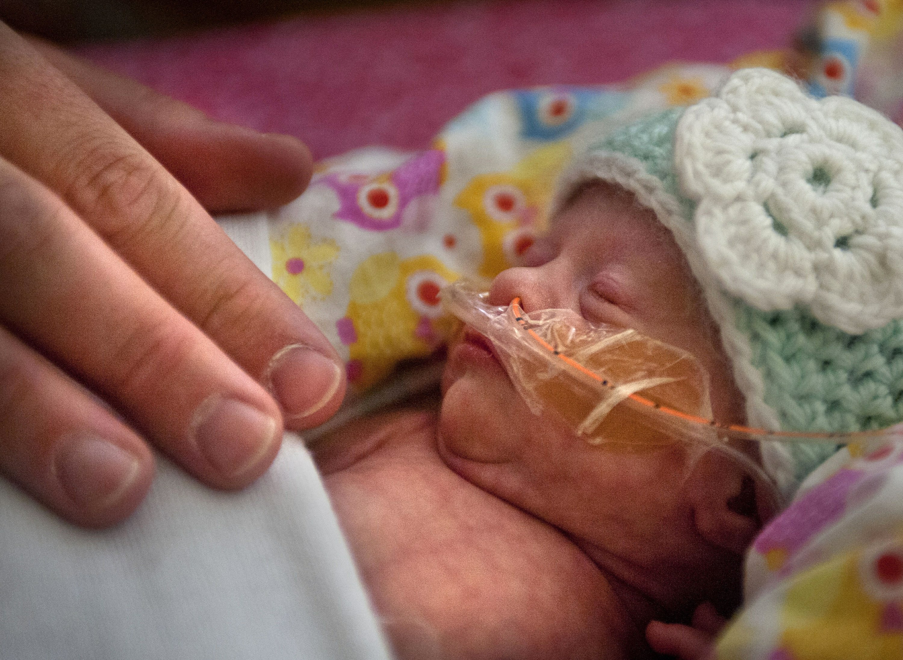 2-pound Michigan baby undergoes heart procedure | AP News