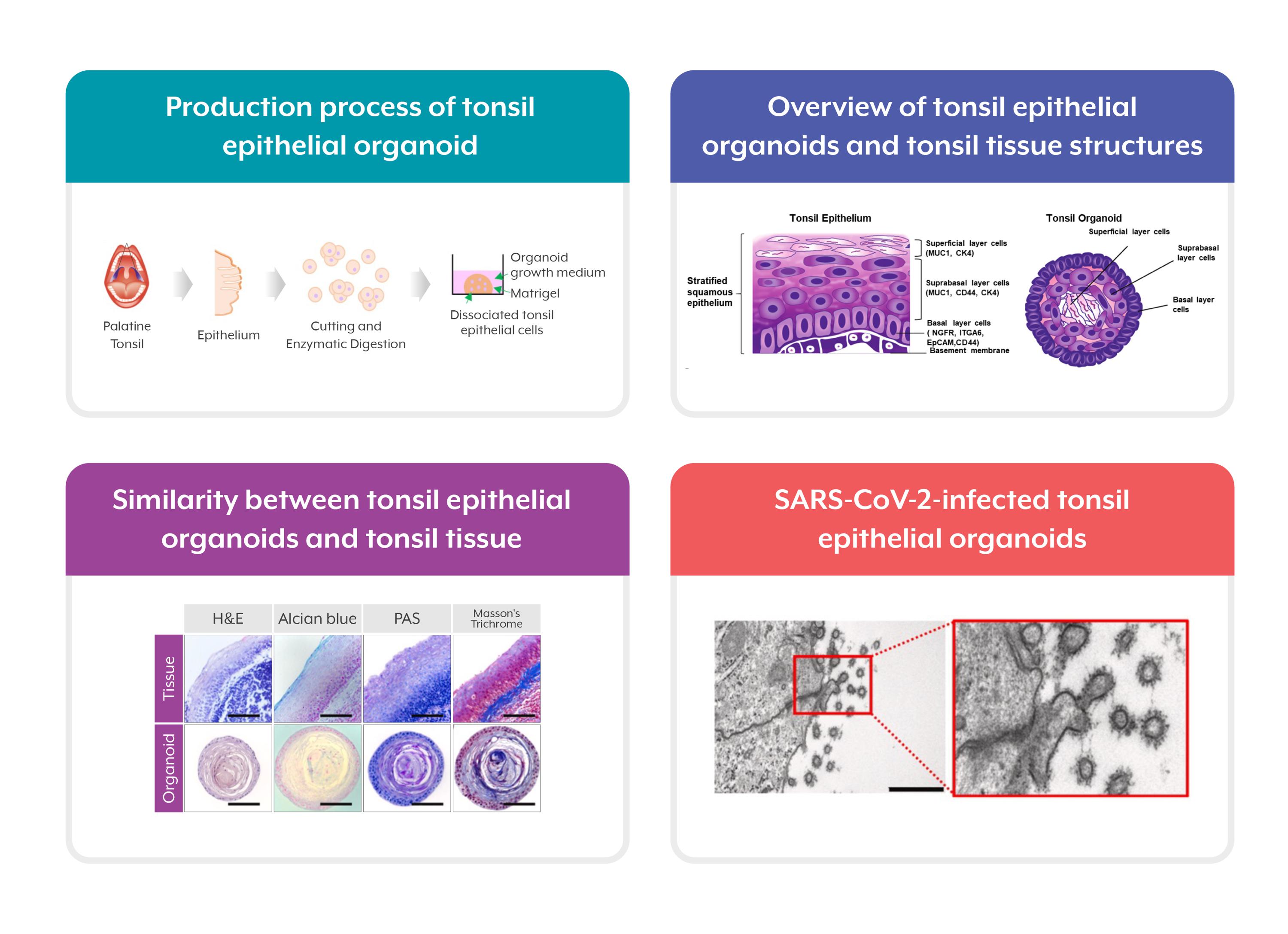 World’s-First Tonsil Epithelial Organoids Model for SARS-CoV-2 ...