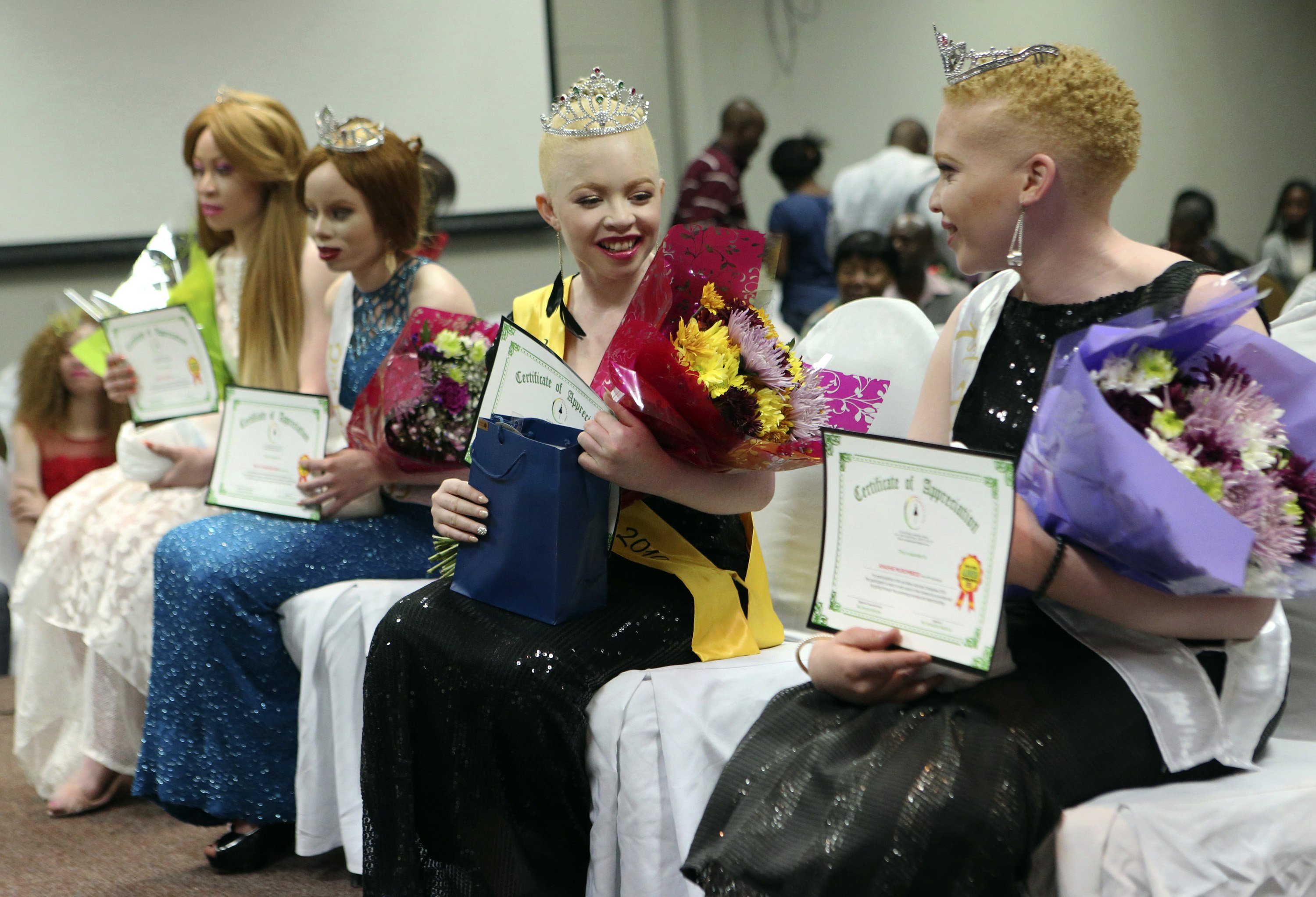 Albinism pageant in Zimbabwe joyfully breaks down prejudice | AP News