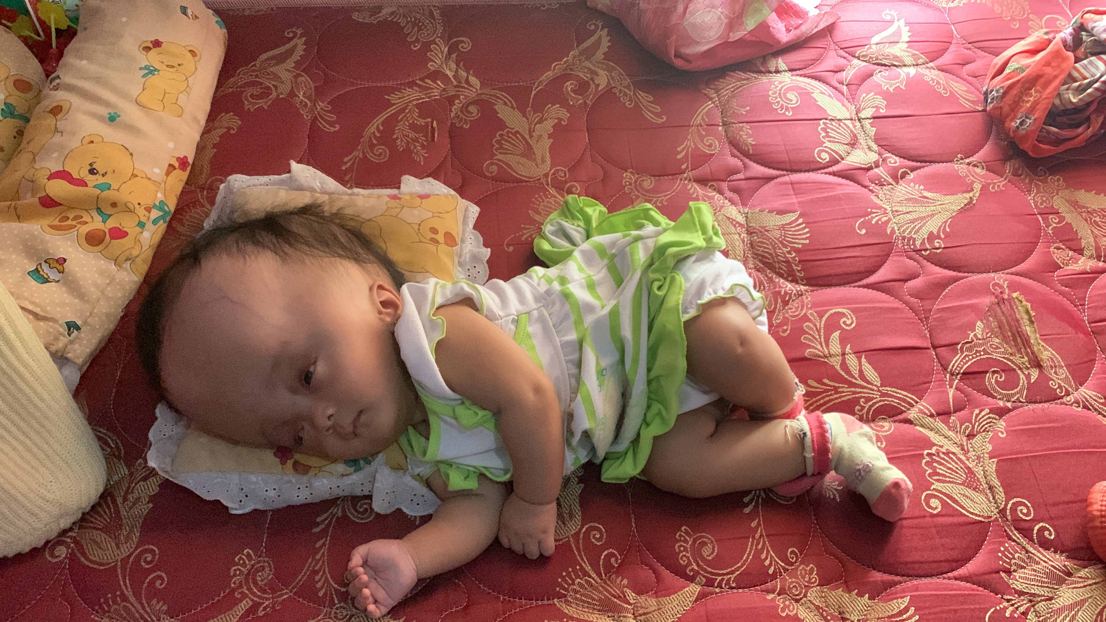 SharingHappiness | Bantu Sembuh Pejuang Hidrosefalus