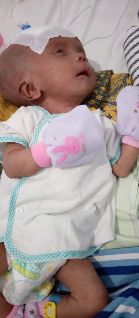 SharingHappiness | Bantu Sembuh Pejuang Hidrosefalus