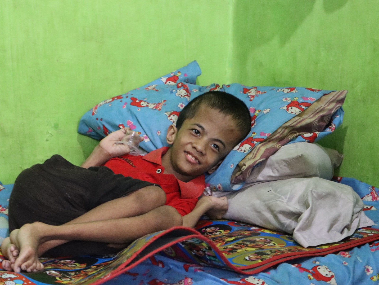 SharingHappiness | Pejuang Hidrosefalus Bantu Ahmad untuk sembuh