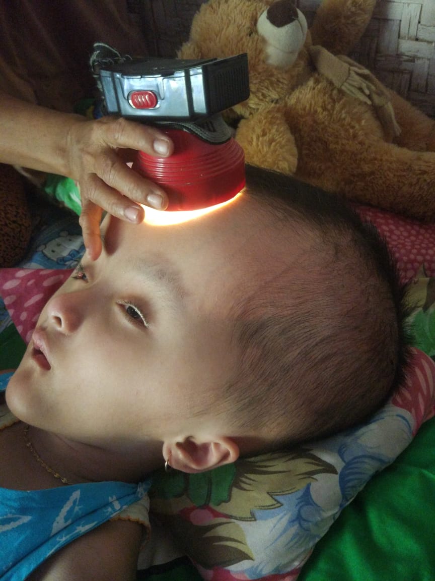 SharingHappiness | Bantu Sembuh Pejuang Hidrosefalus