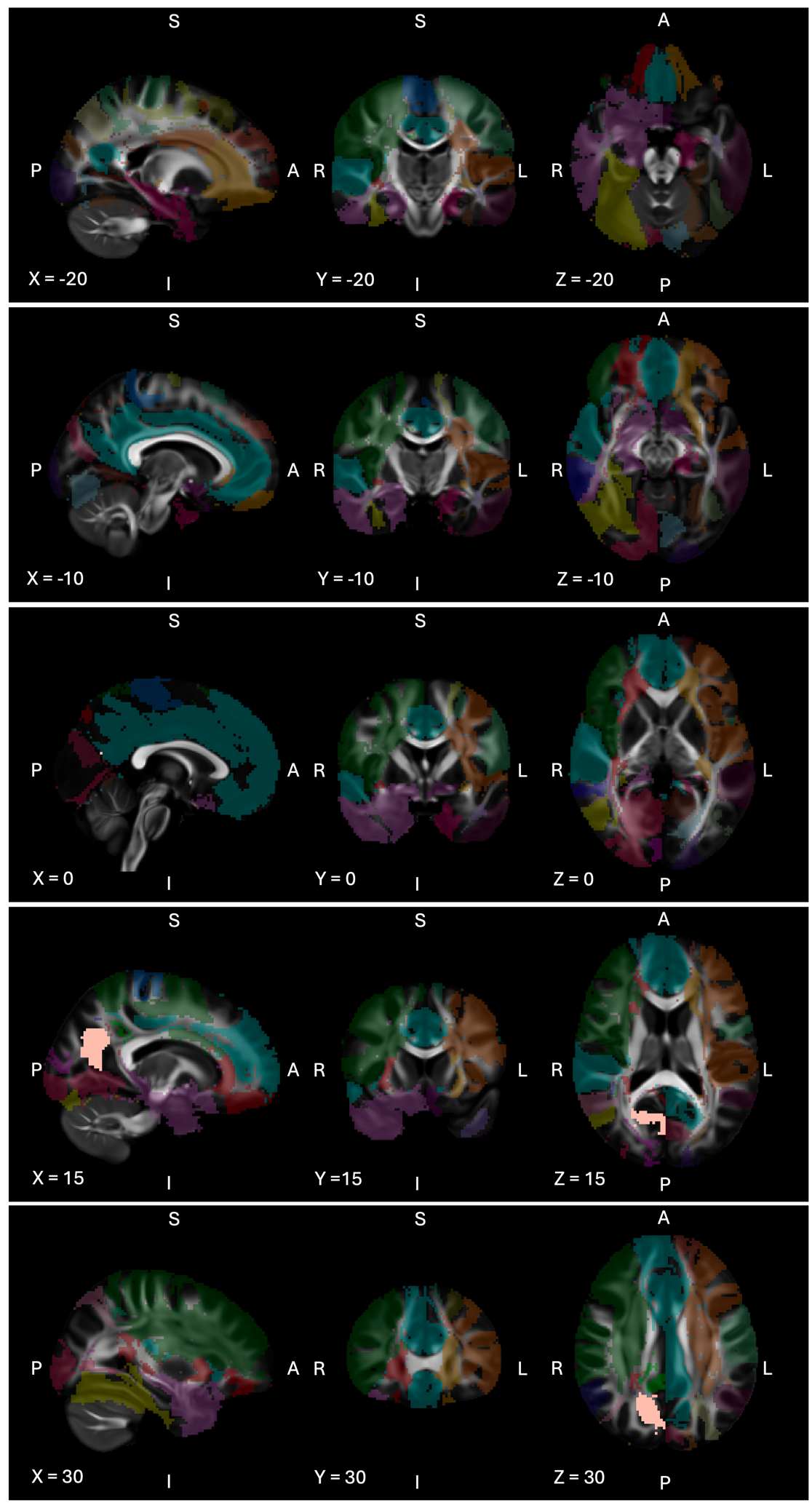 Association Parcellation Parcel 2