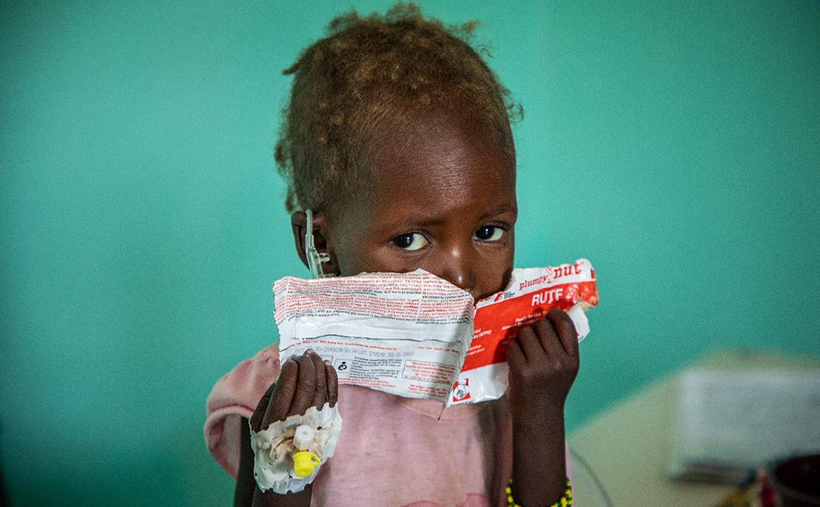 一包 Plumpy' nut 背後的故事：我如何從難民兒童，成為無國界醫生職員｜無國界醫生｜換日線