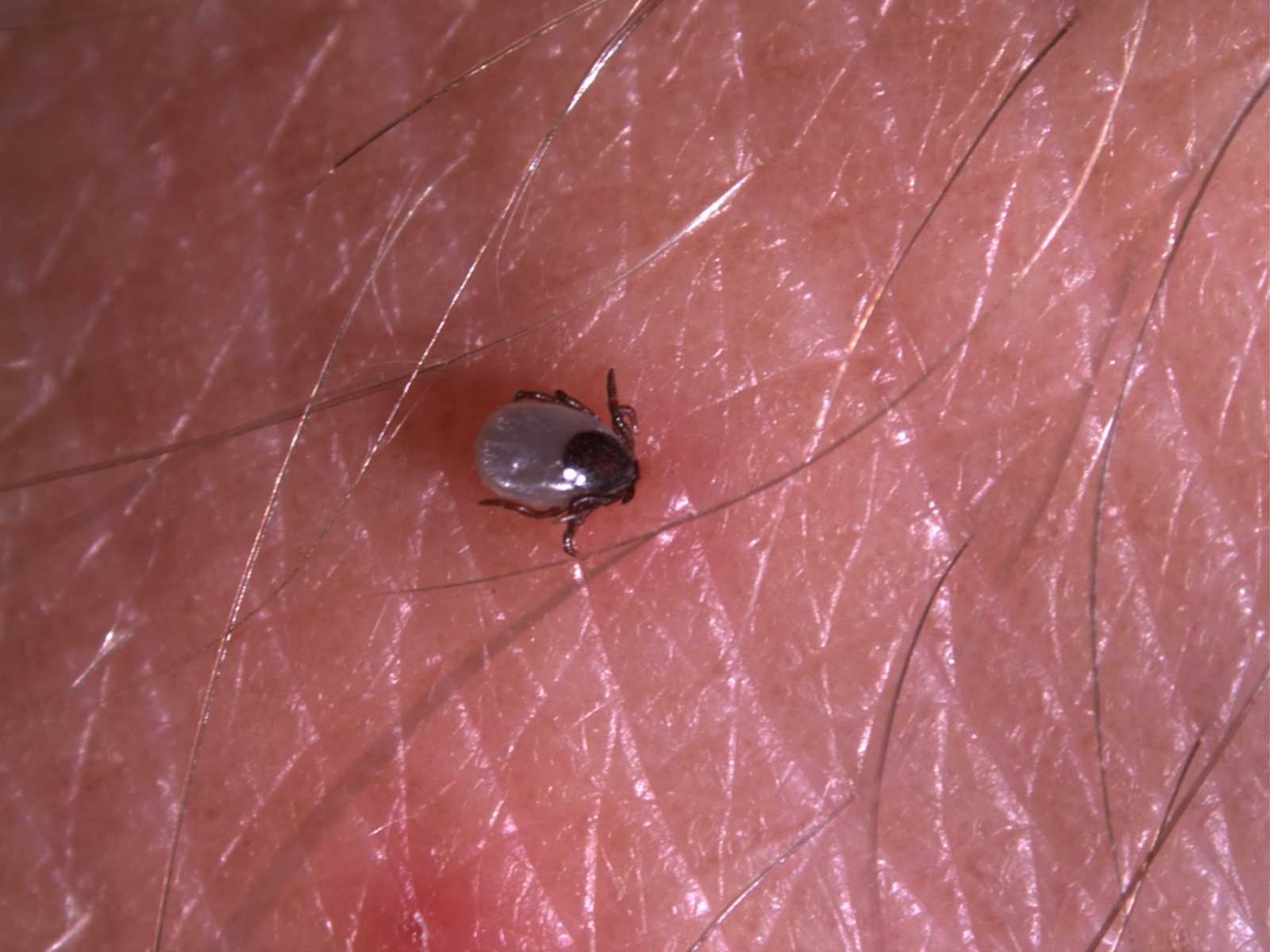 Tick Labeled Image Dataset | images.cv