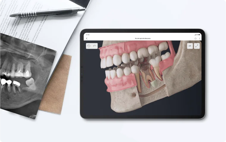 VOKA 3D Anatomy & Pathology