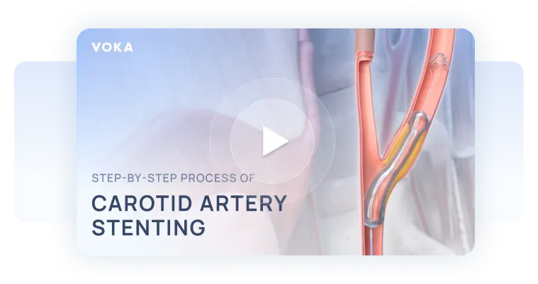 3D medical animation services & company | VOKA