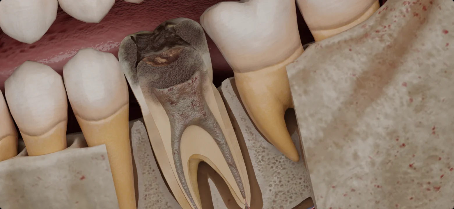 VOKA 3D Anatomy & Pathology