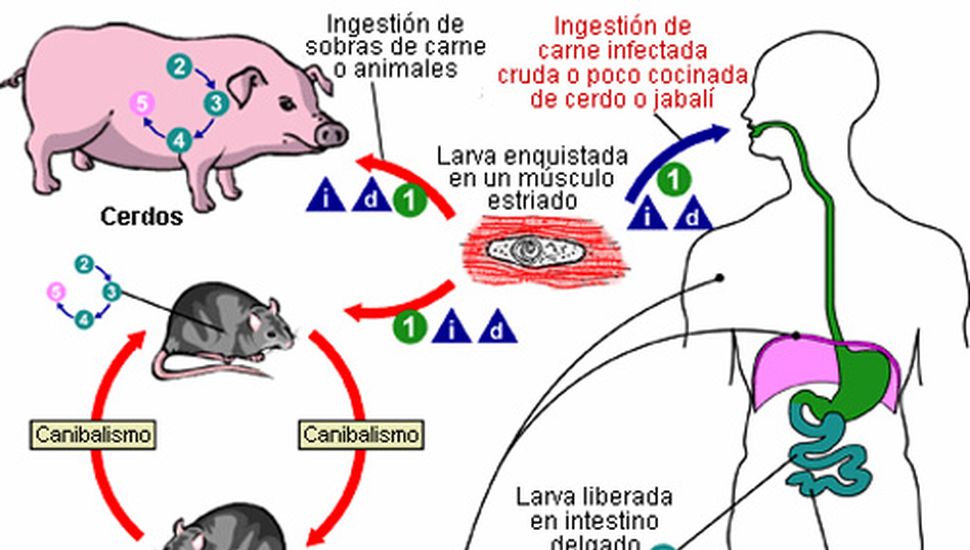 Investigan si hay pacientes con triquinosis en nuestra ciudad • Diario ...