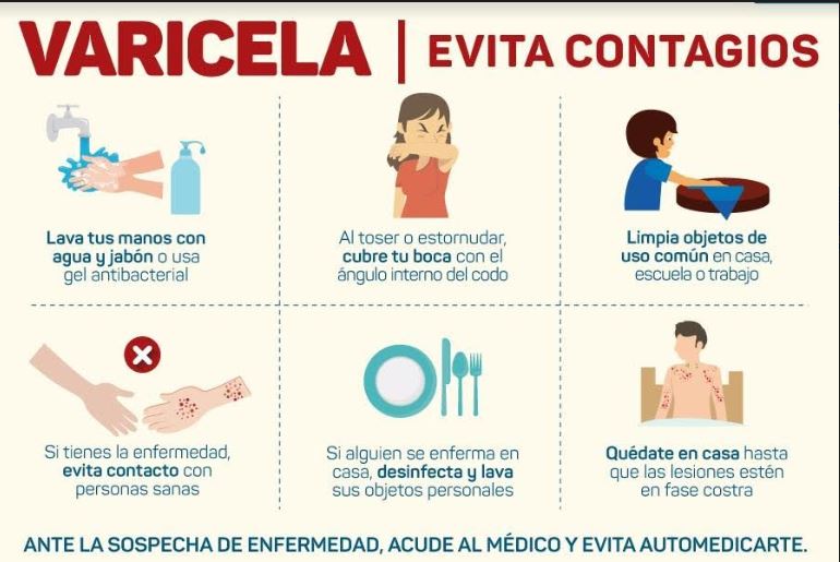 Varicela: medidas de prevención y control • Diario Democracia
