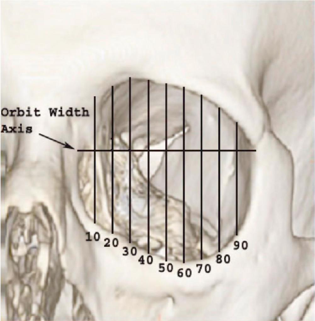 Aging of the facial skeleton - Clinical Tree