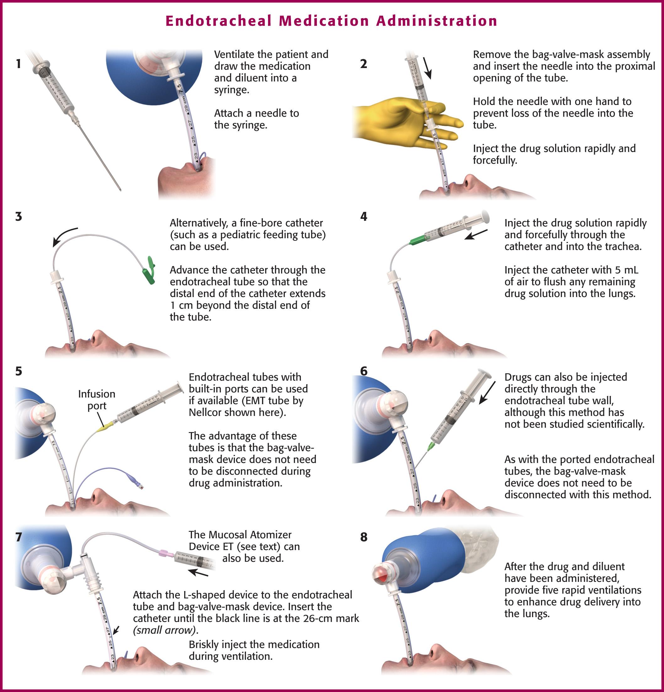 Alternative Methods of Drug Administration - Clinical Tree