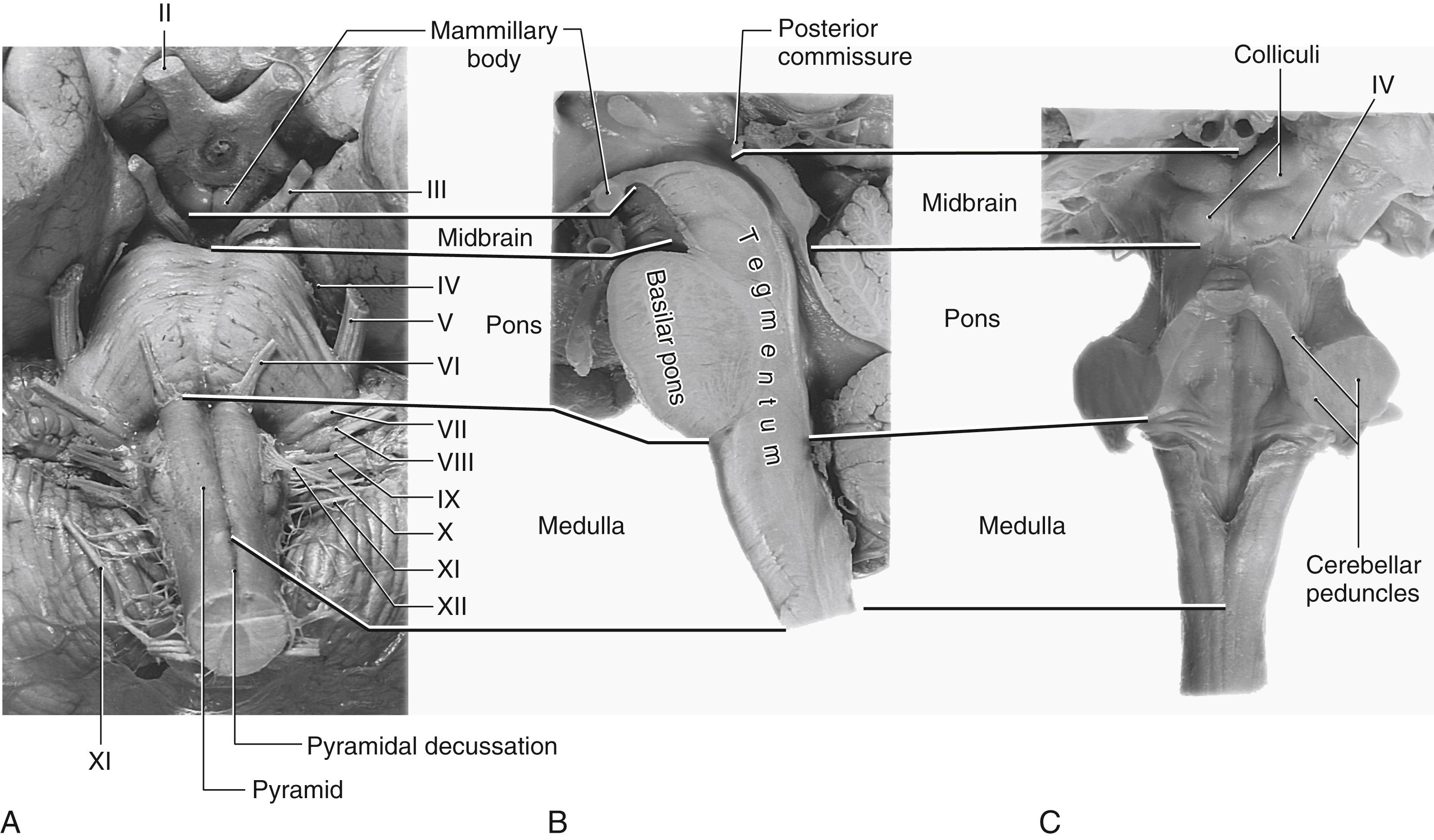 An Overview of the Brainstem - Clinical Tree