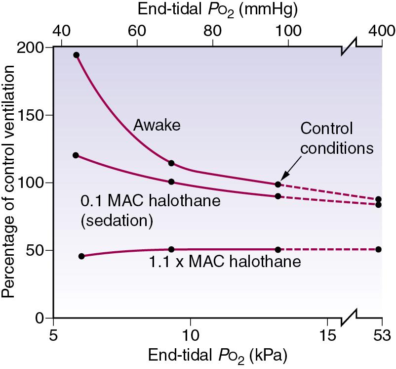 Anaesthesia - Clinical Tree