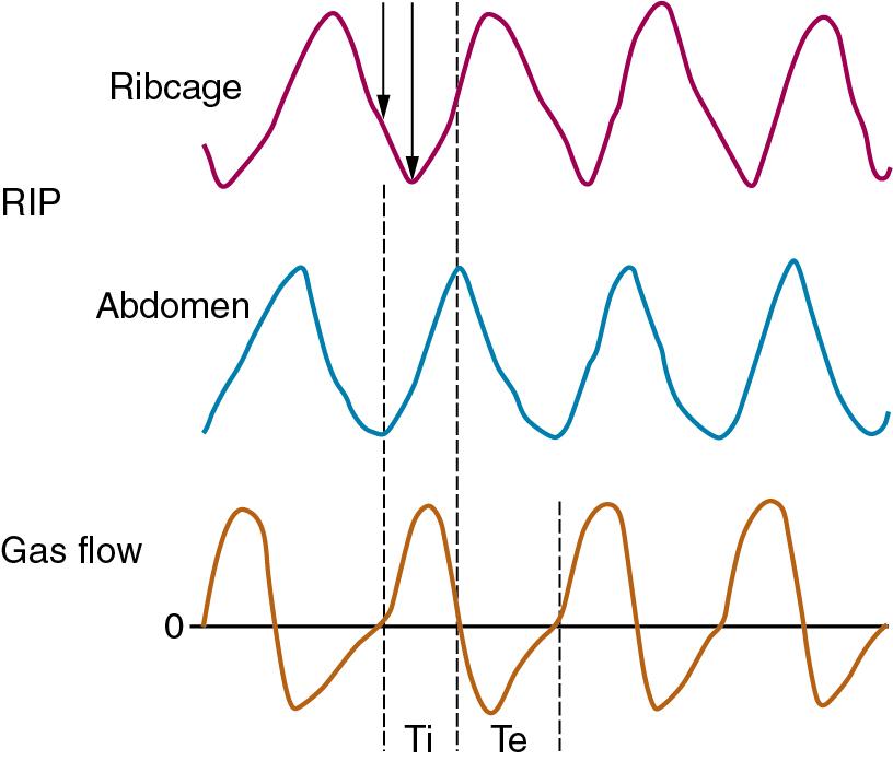 Anaesthesia - Clinical Tree