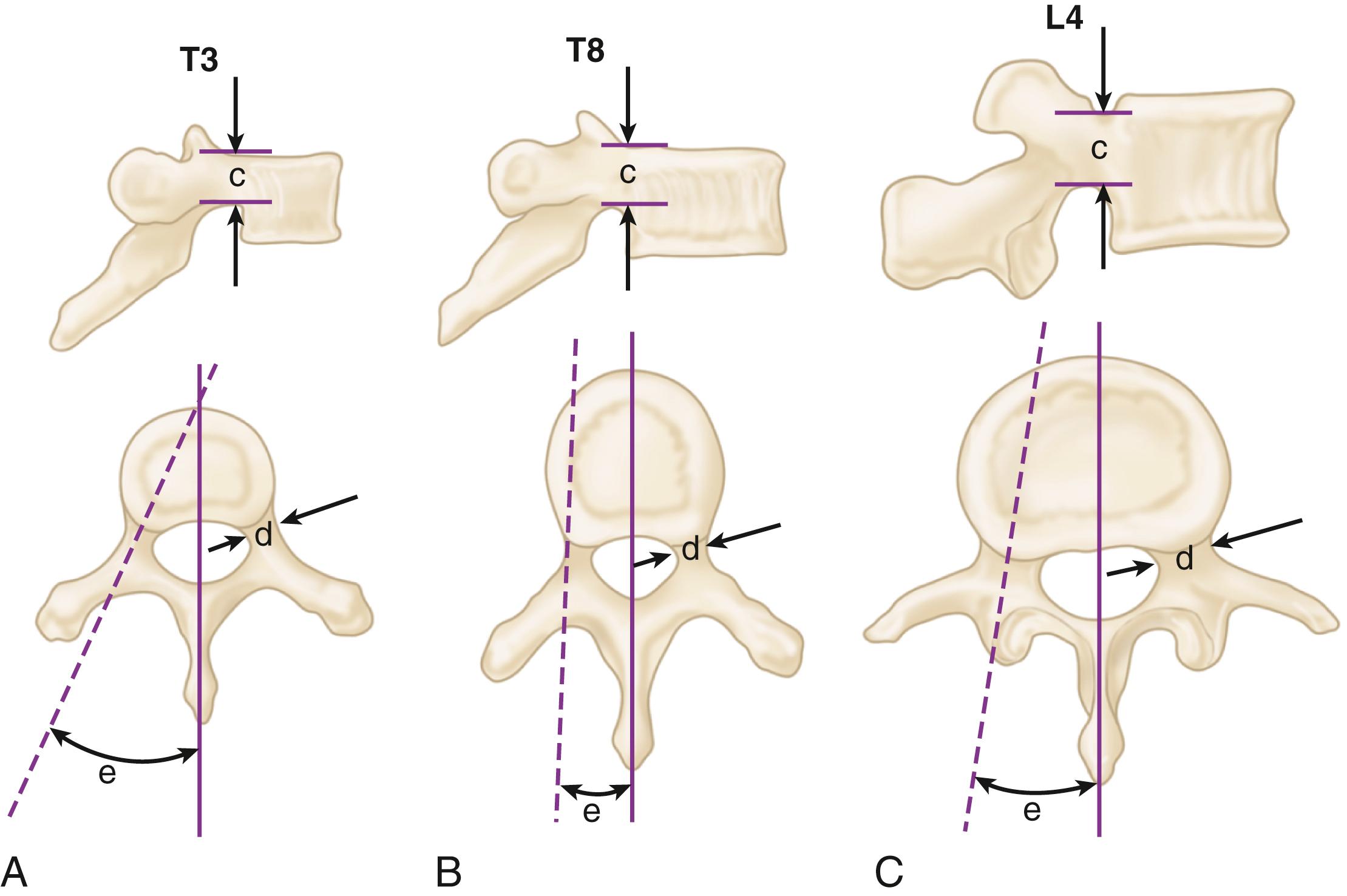 Anatomic Approaches to the Spine - Clinical Tree