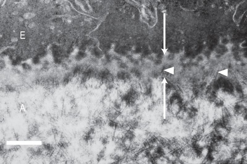 Anatomy and Physiology of the Cornea and Related Structures - Clinical Tree