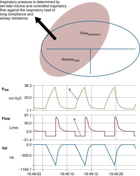 Anesthesia Ventilators - Clinical Tree