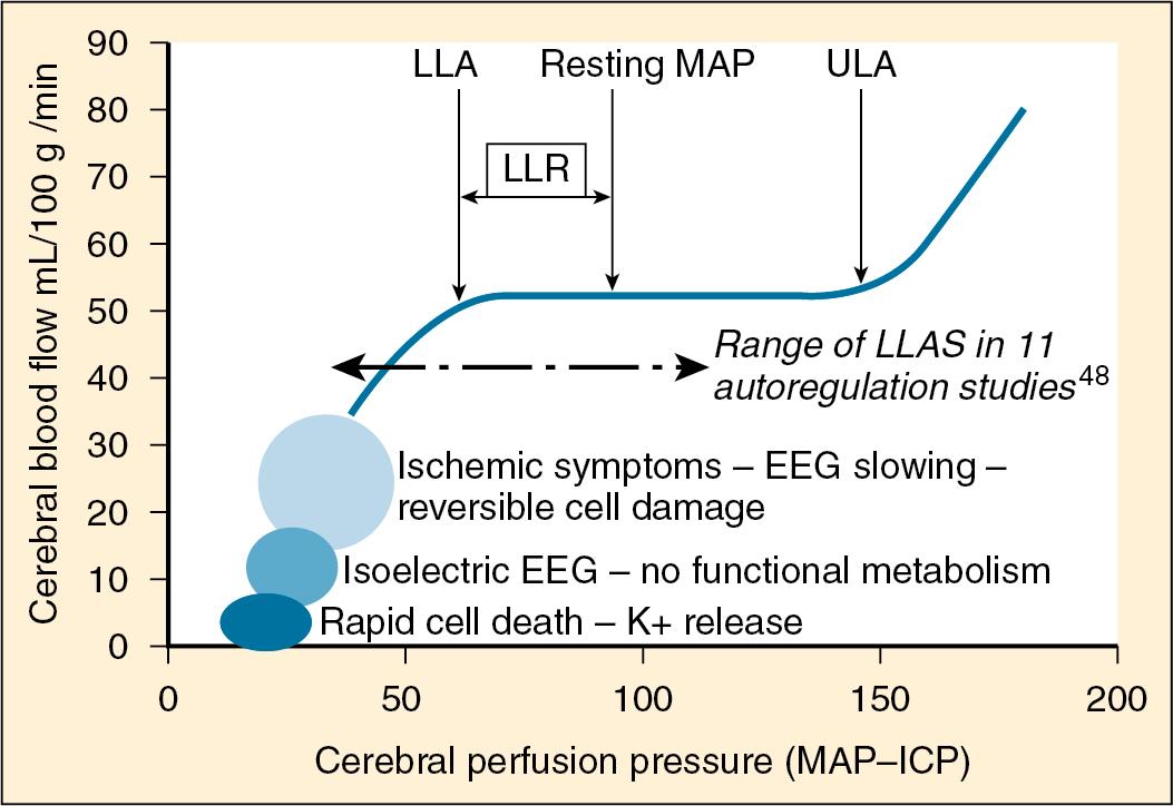 Anesthesia for neurosurgery - Clinical Tree