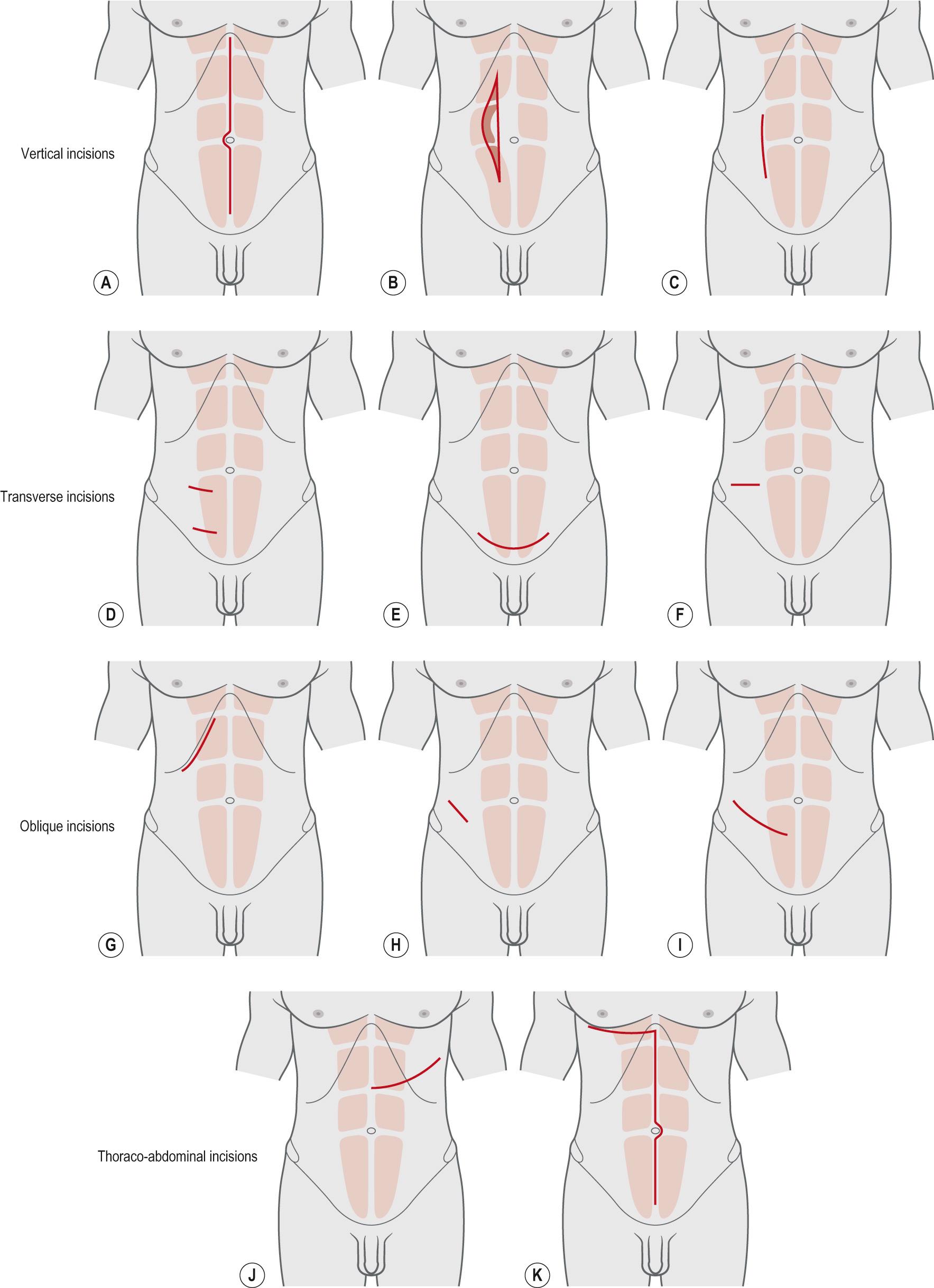Anterior Abdominal Wall And Inguinal Region Clinical Tree