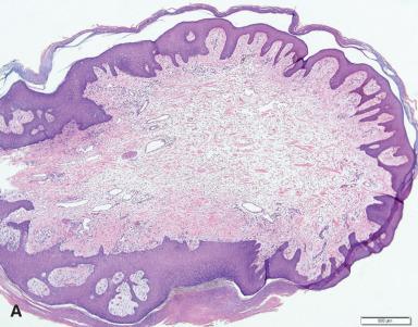 Anus - Clinical Tree