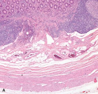 Appendix - Clinical Tree