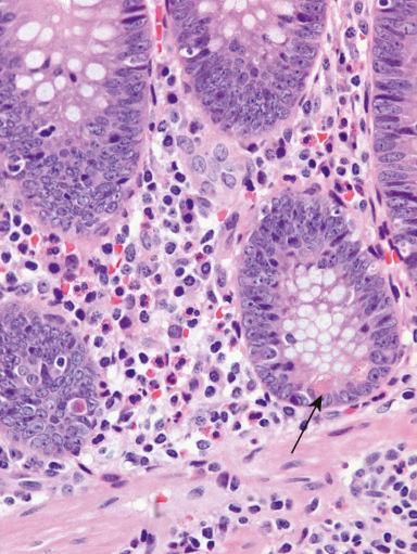 Appendix - Clinical Tree