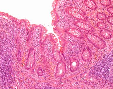 Appendix - Clinical Tree