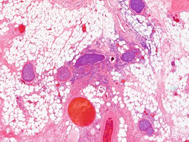 Appendix - Clinical Tree