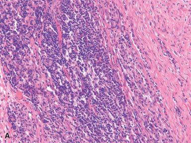 Appendix - Clinical Tree