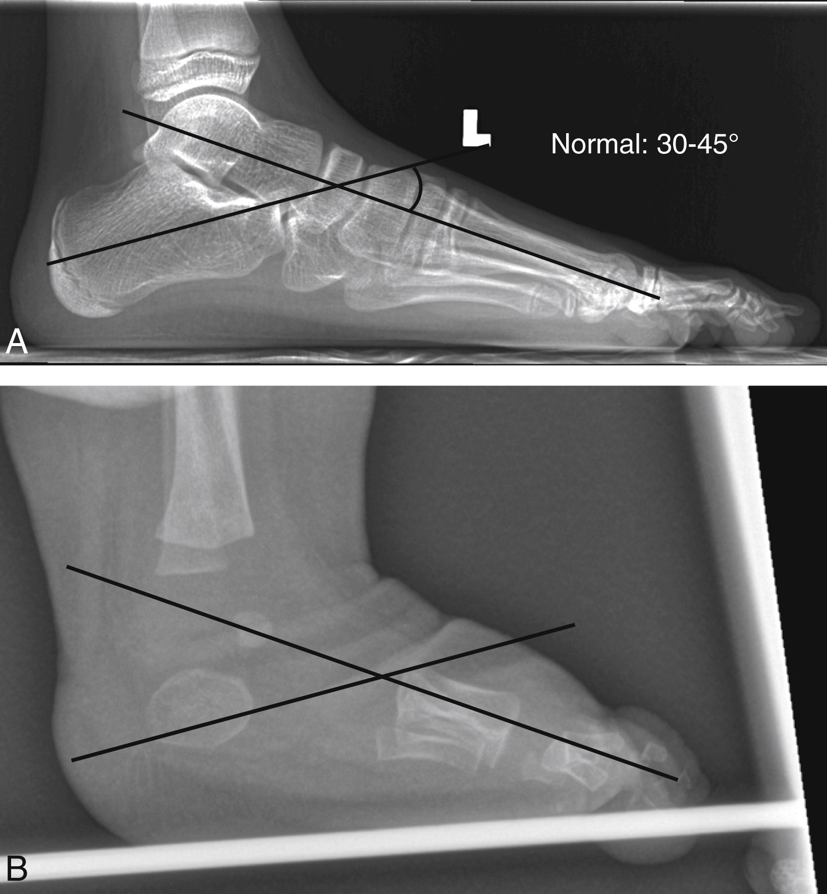 Approach to Pediatric Foot - Clinical Tree