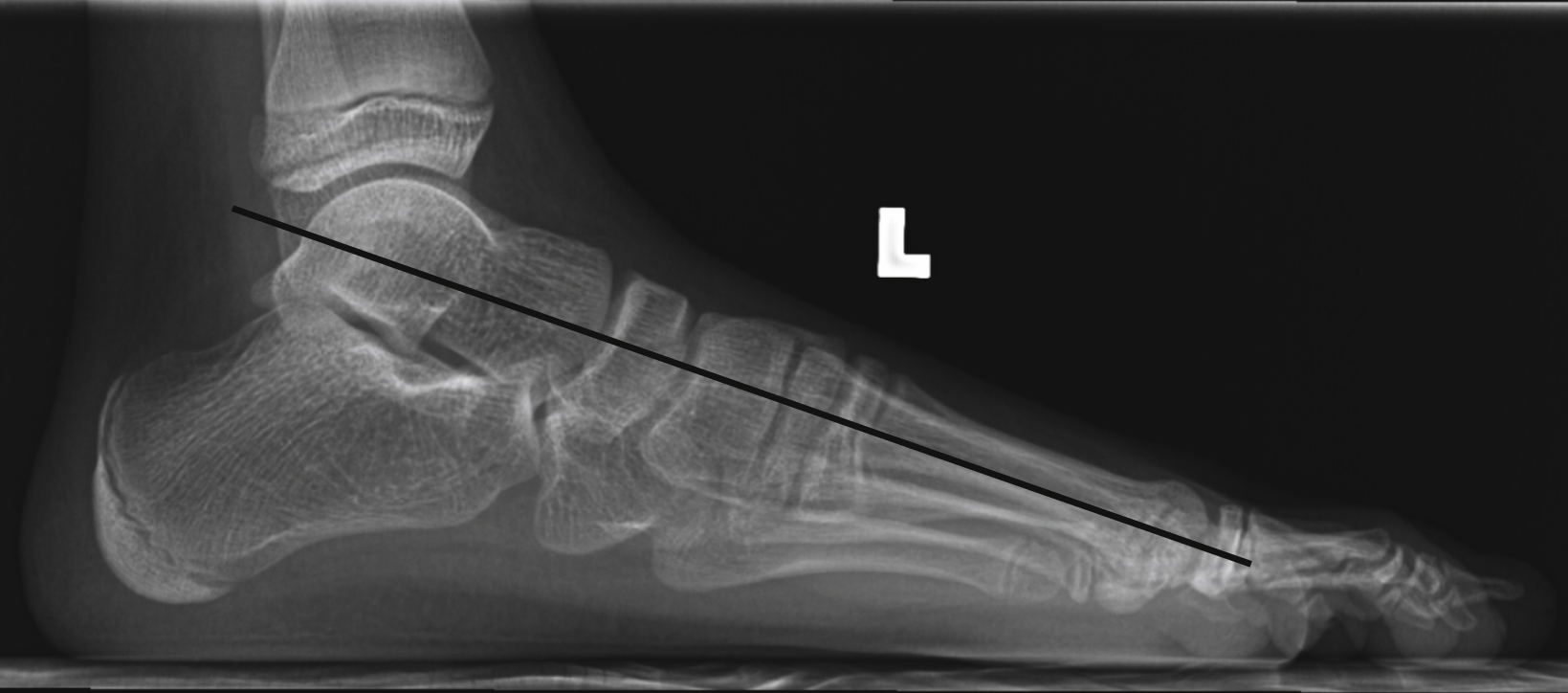 Approach to Pediatric Foot - Clinical Tree