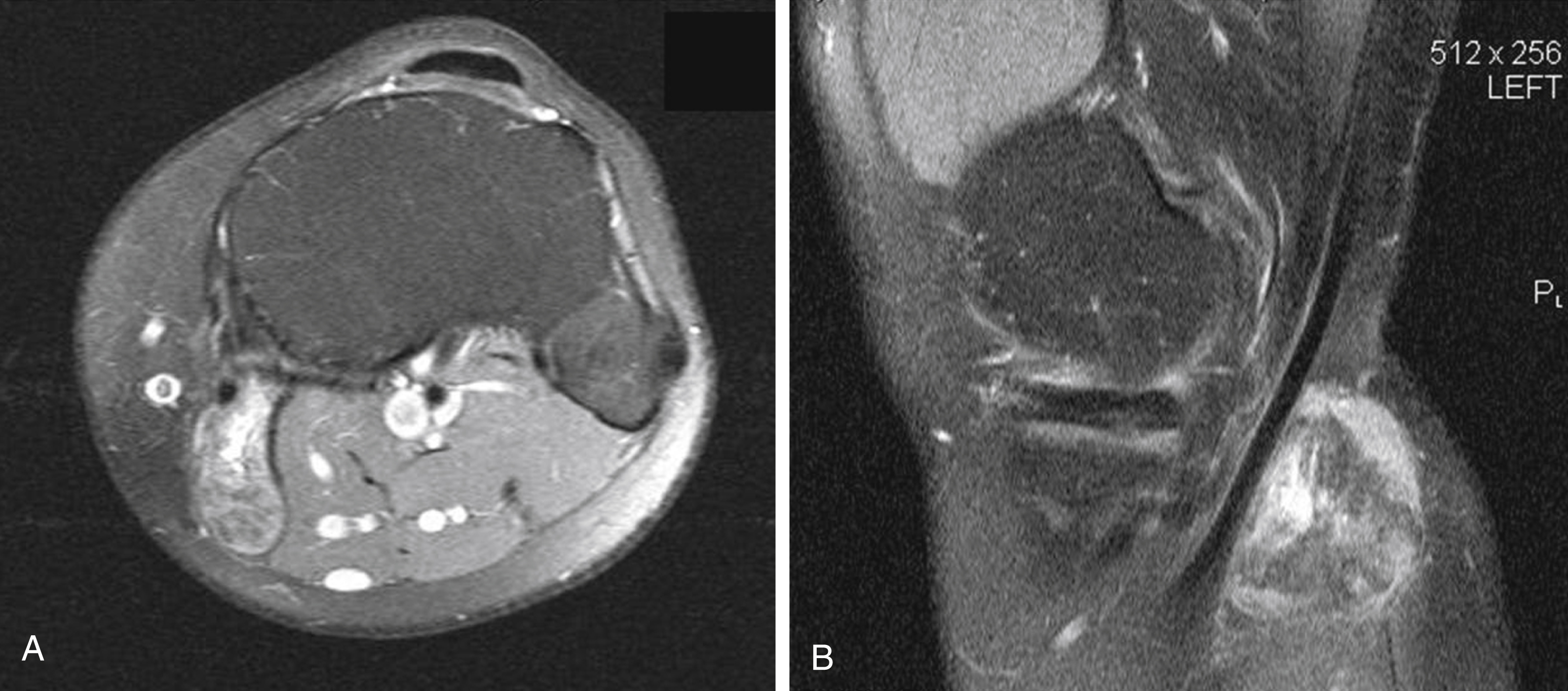 Approach to Pediatric Soft Tissue Masses - Clinical Tree