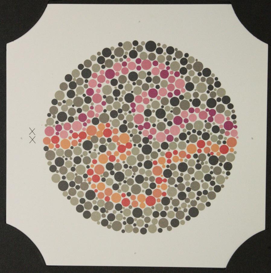 Assessment of visual function - Clinical Tree