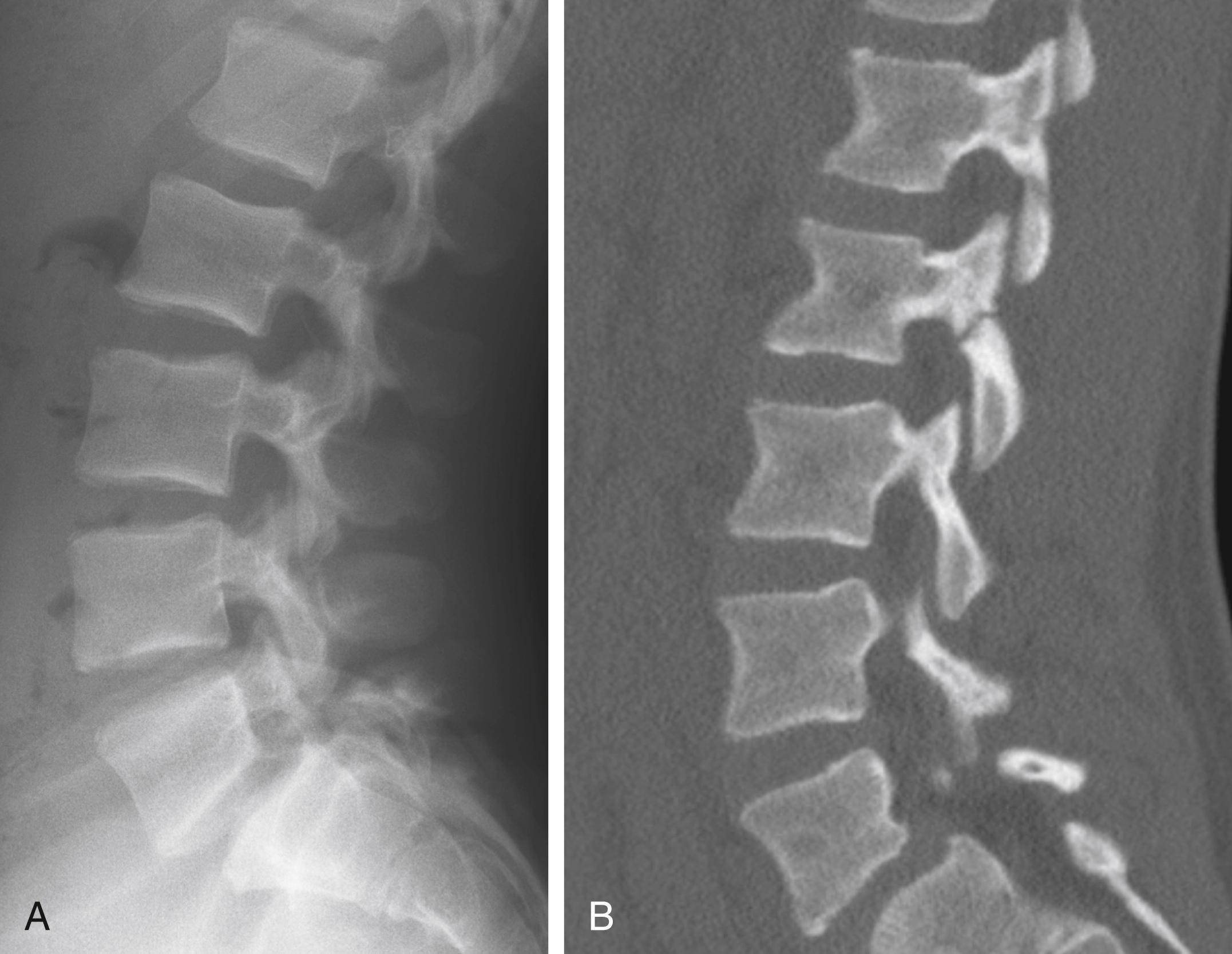 Back Pain - Clinical Tree