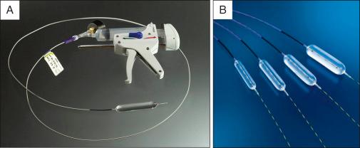 Balloon Dilation of the Native and Postsphincterotomy Papilla ...