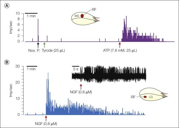 Basic Mechanisms of Muscle Pain - Clinical Tree