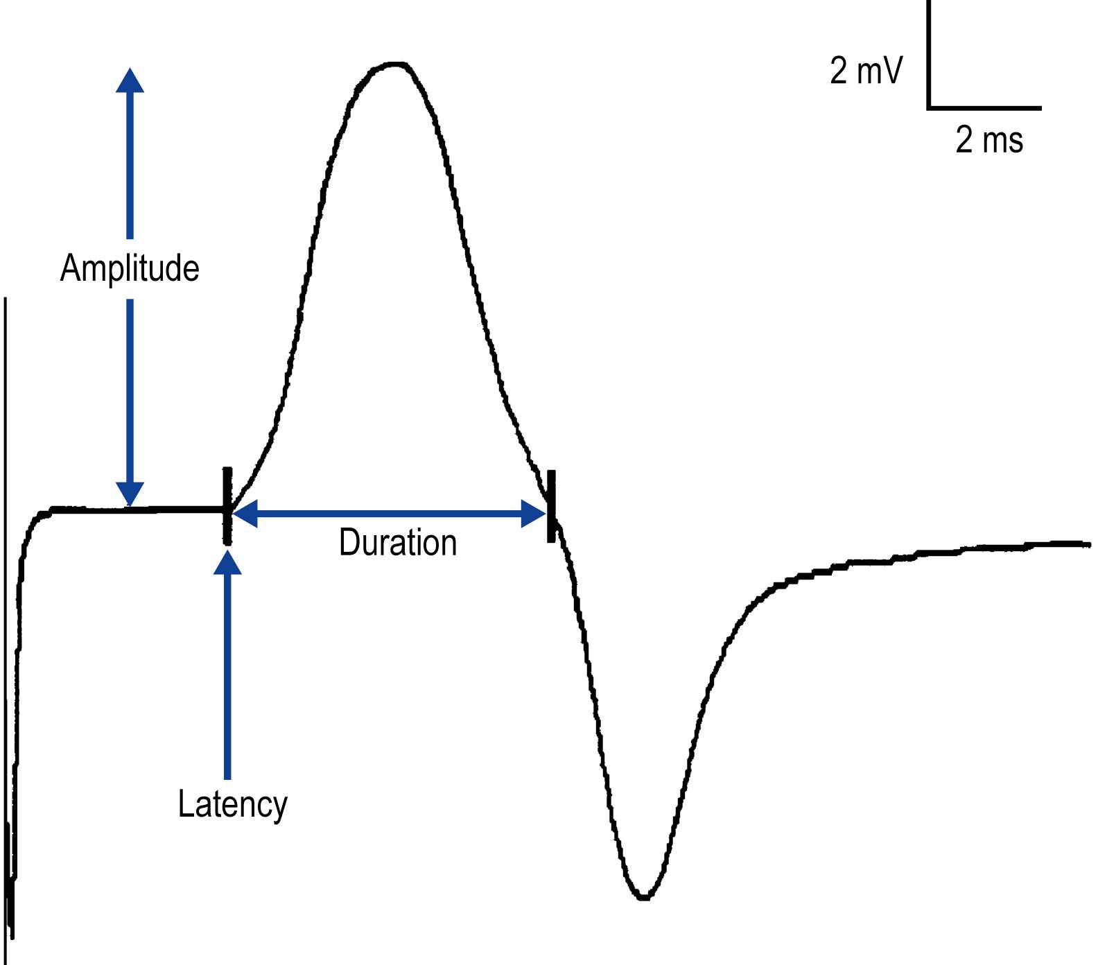 Basic Nerve Conduction Studies - Clinical Tree