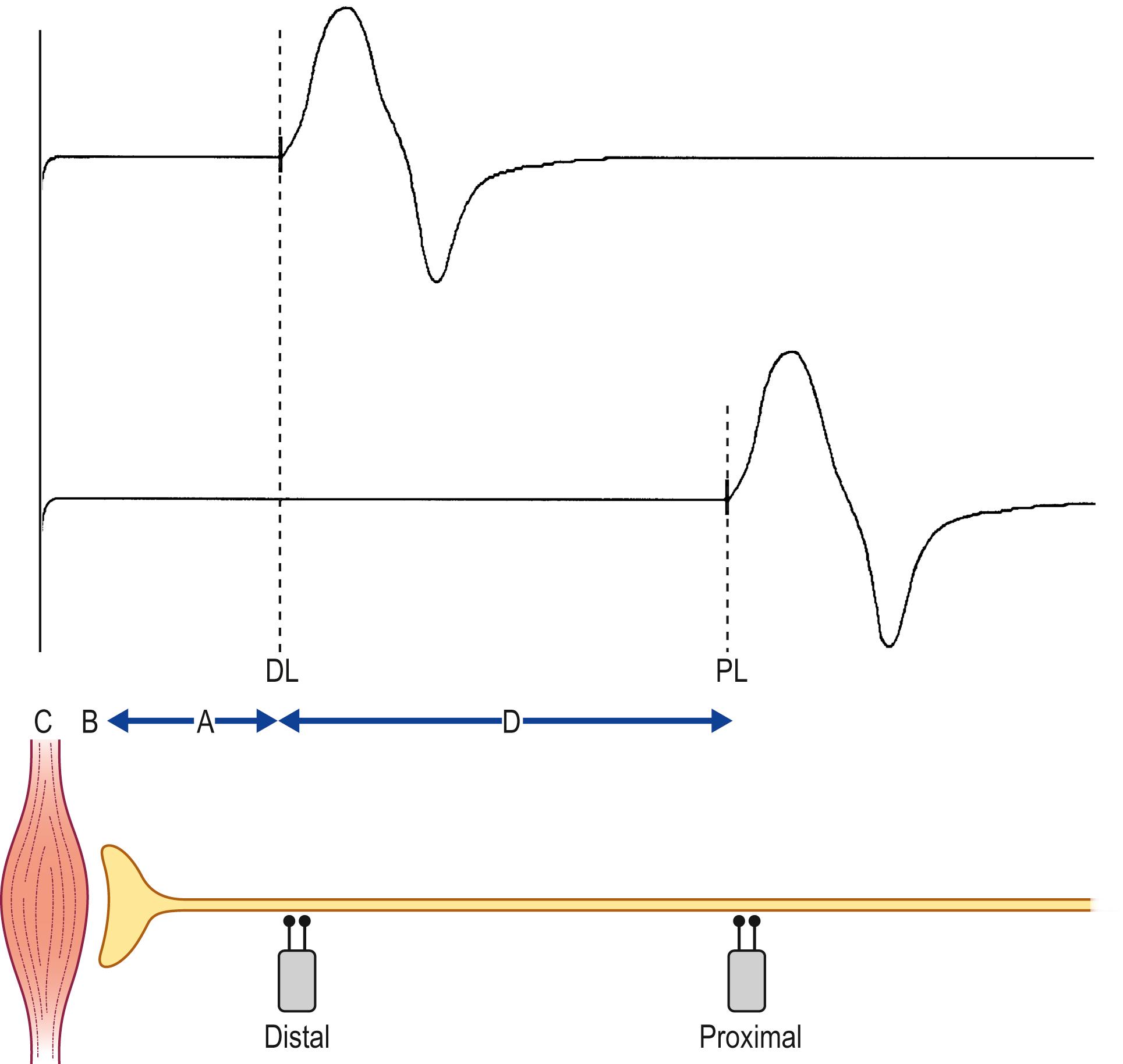 Basic Nerve Conduction Studies - Clinical Tree