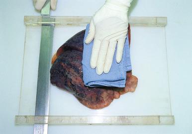 Basic Postmortem Examination - Clinical Tree