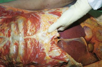 Basic Postmortem Examination - Clinical Tree