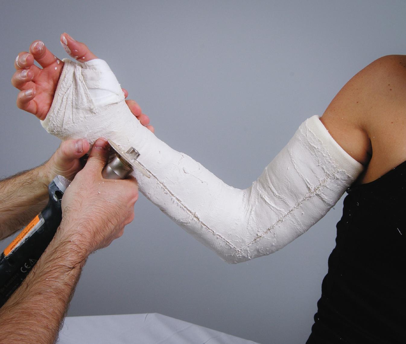 Basics of Splinting and Casting - Clinical Tree