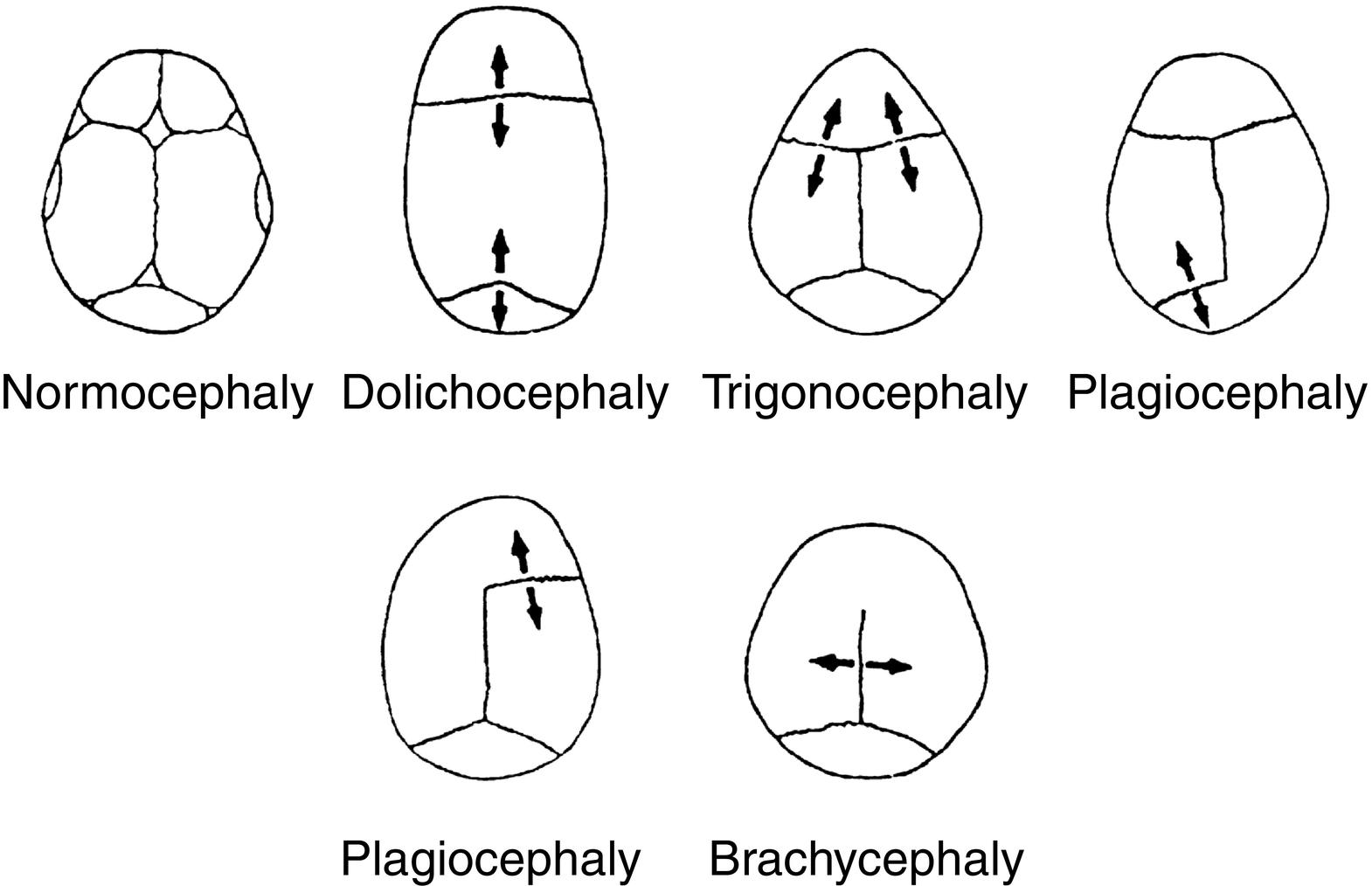 Behavior and development - Clinical Tree