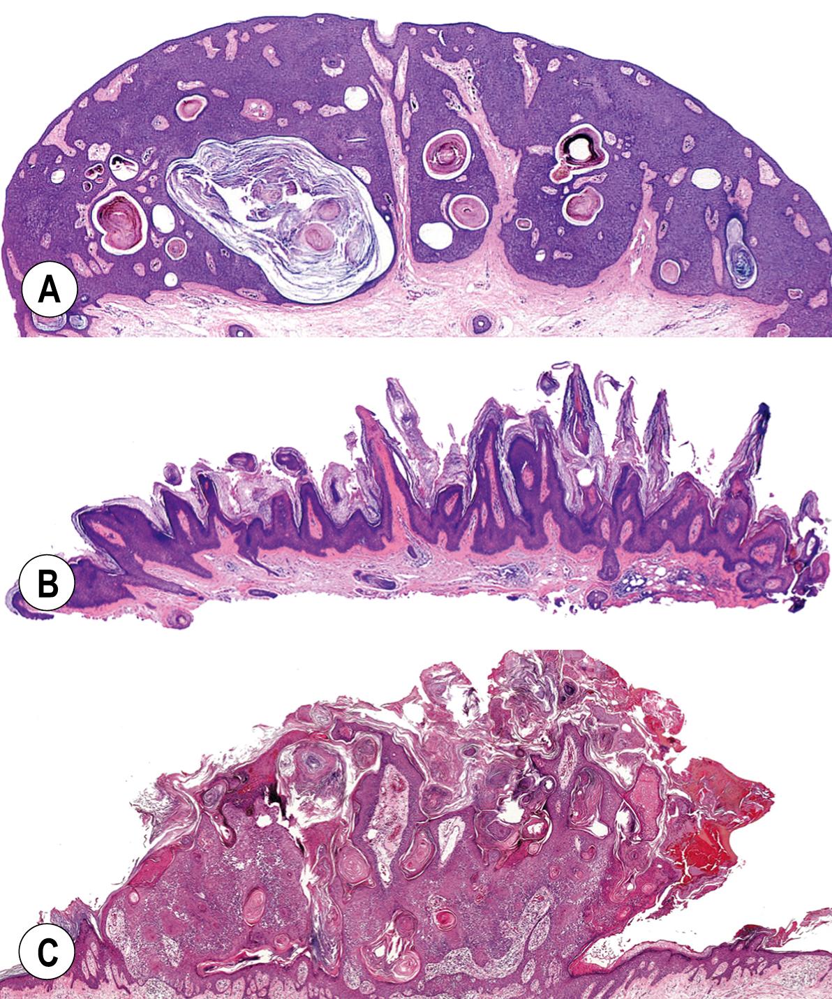 Benign Epithelial Tumors And Proliferations Clinical Tree