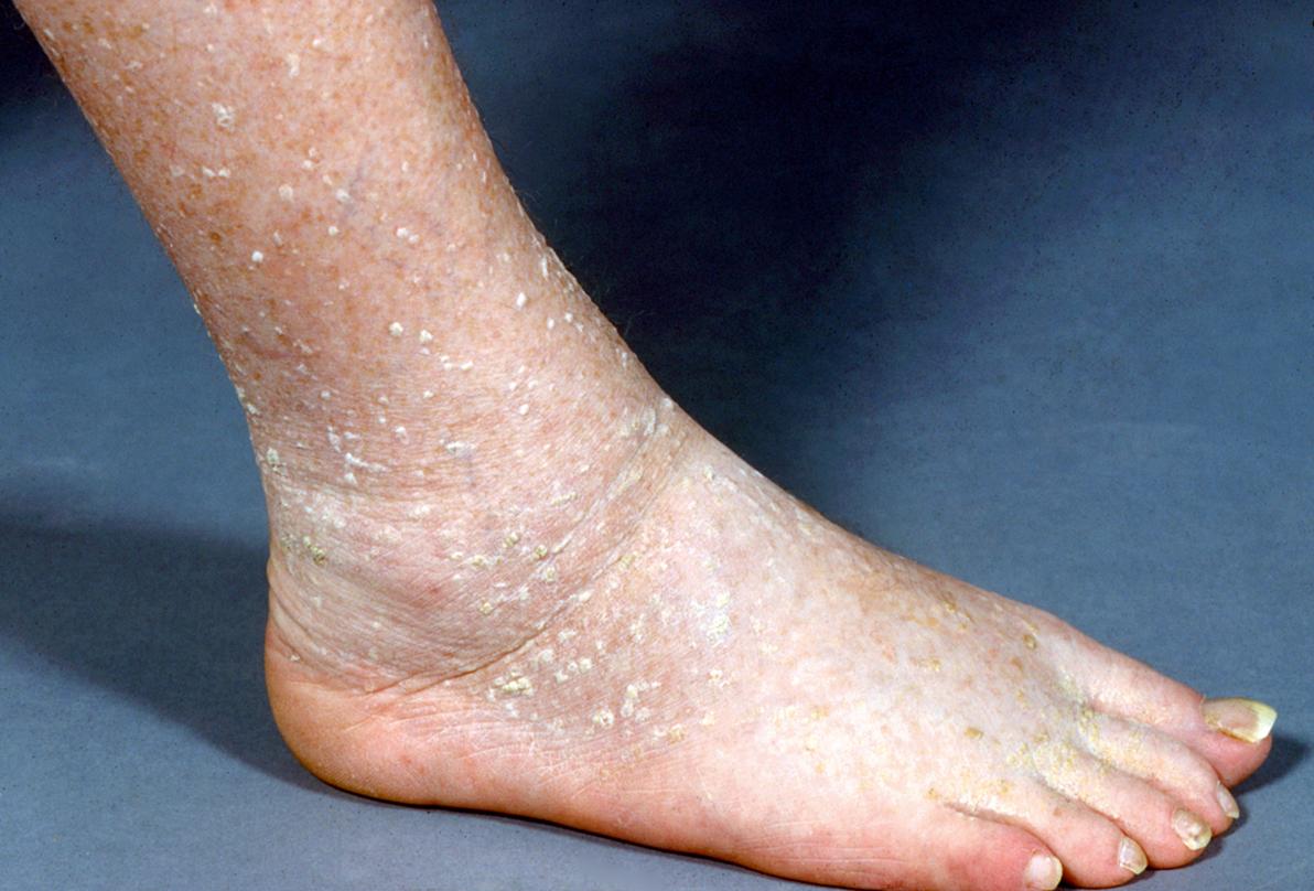 Benign Epithelial Tumors And Proliferations Clinical Tree