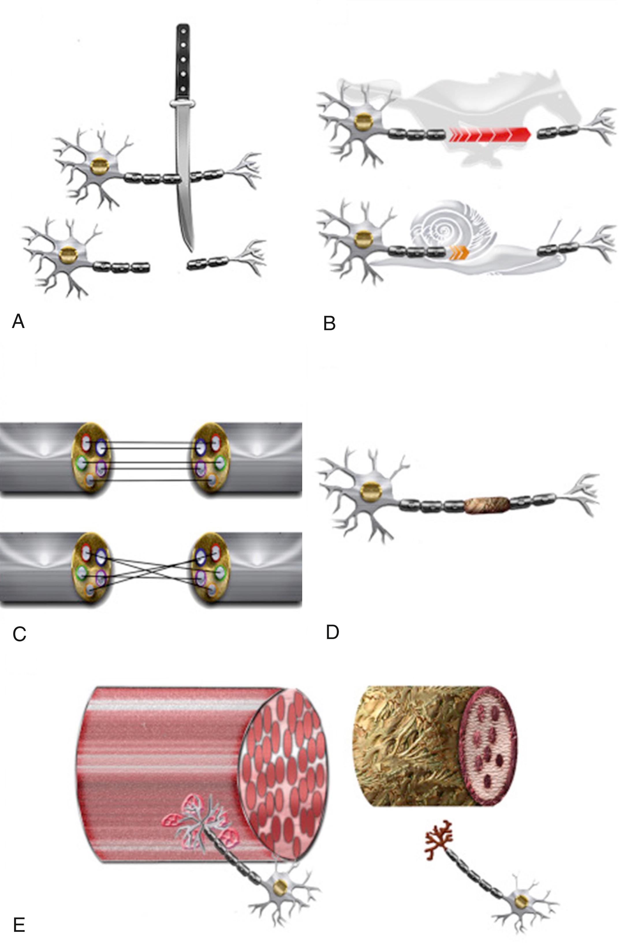 Biologic Augmentation in Peripheral Nerve Repair - Clinical Tree